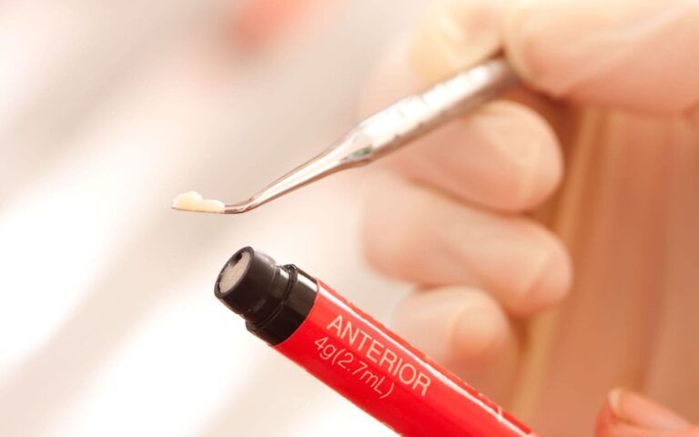 How Direct Composite Resin Can Treat Traumatic Dental Injuries » Los ...
